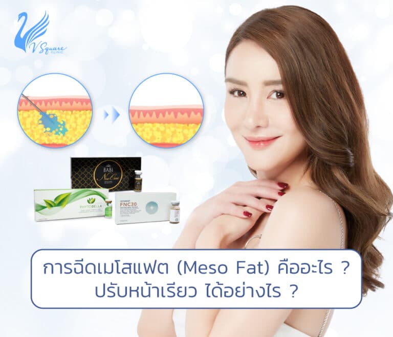 เมโสแฟต (Meso Fat) คืออะไร ช่วยเรื่องอะไร ต่างจากการฉีดโบท็อก Hifu อย่างไร
