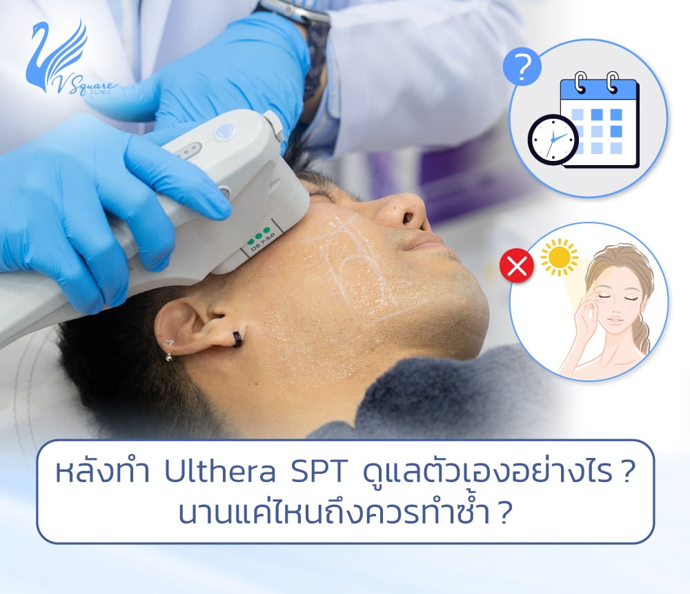 หลังทำ Ulthera (อัลเทอร่า) ควรปฏิบัติตัวอย่างไรให้ผลลัพธ์อยู่ได้นาน