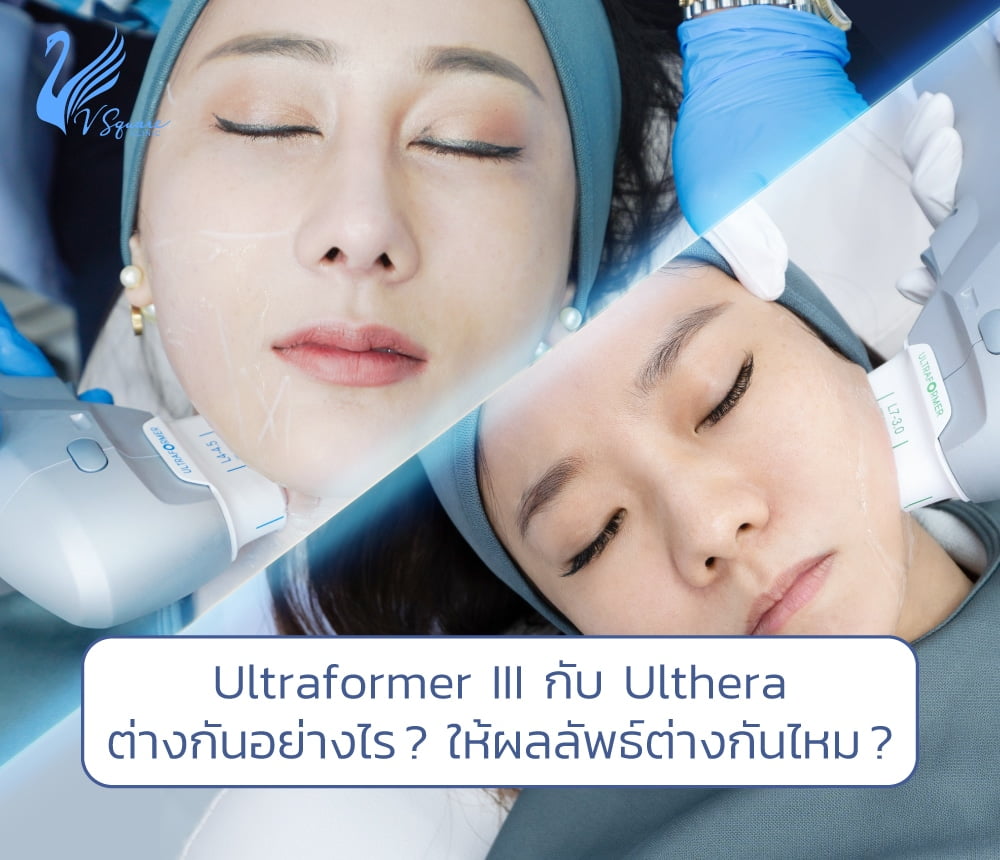 Ultraformer III กับ Ulthera ต่างกันอย่างไร? เหมาะกับใคร เลือกแบบไหนดี?