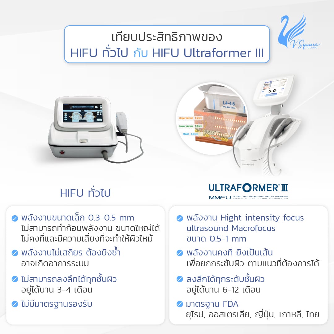 Ultraformer III กับ Ulthera ต่างกันอย่างไร? เหมาะกับใคร เลือกแบบไหนดี?
