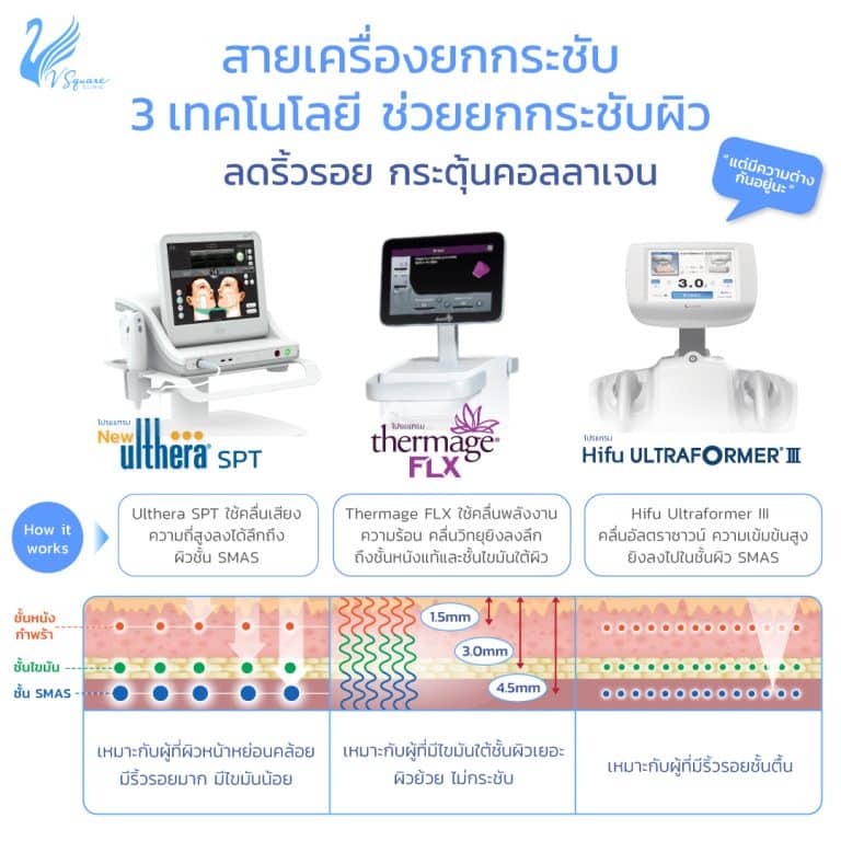 Ultraformer III เครื่องยกกระชับ ลดริ้วรอย ปรับหน้าวีเชฟ โดยไม่ต้องผ่าตัด
