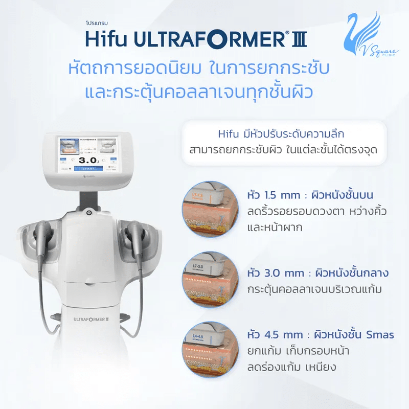 นวัตกรรมเครื่องยกกระชับ Ulthera VS Hifu VS Thermage เลือกแบบไหนดี