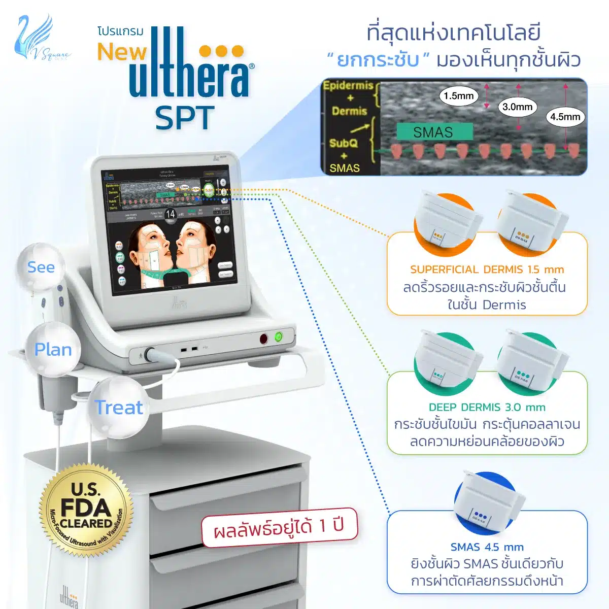 นวัตกรรมเครื่องยกกระชับ Ulthera VS Hifu VS Thermage เลือกแบบไหนดี