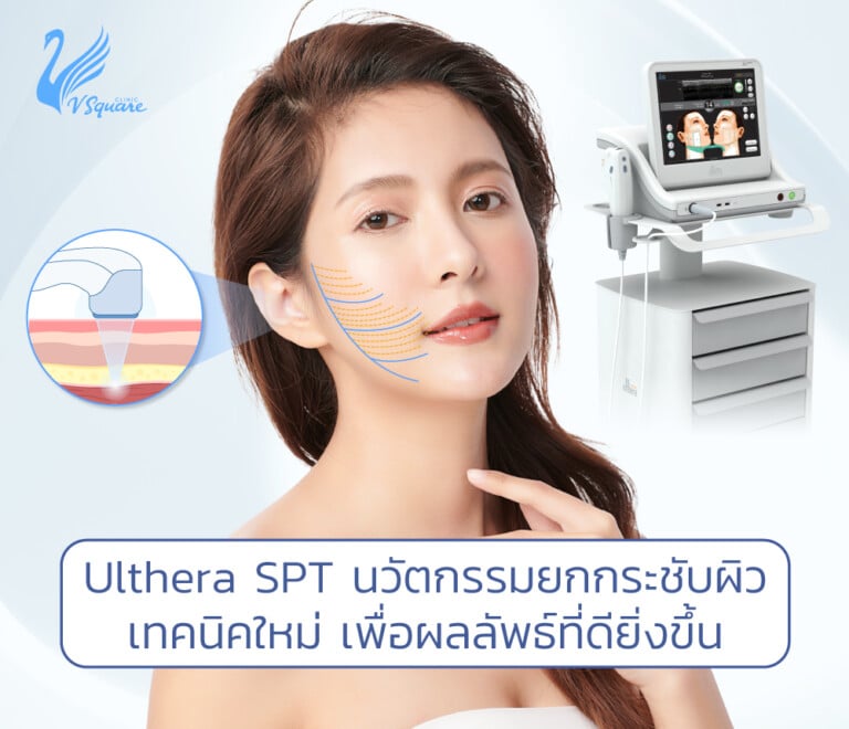 Ulthera SPT นวัตกรรมยกกระชับผิวเทคนิคใหม่ เพื่อผลลัพธ์ที่ดียิ่งขึ้น
