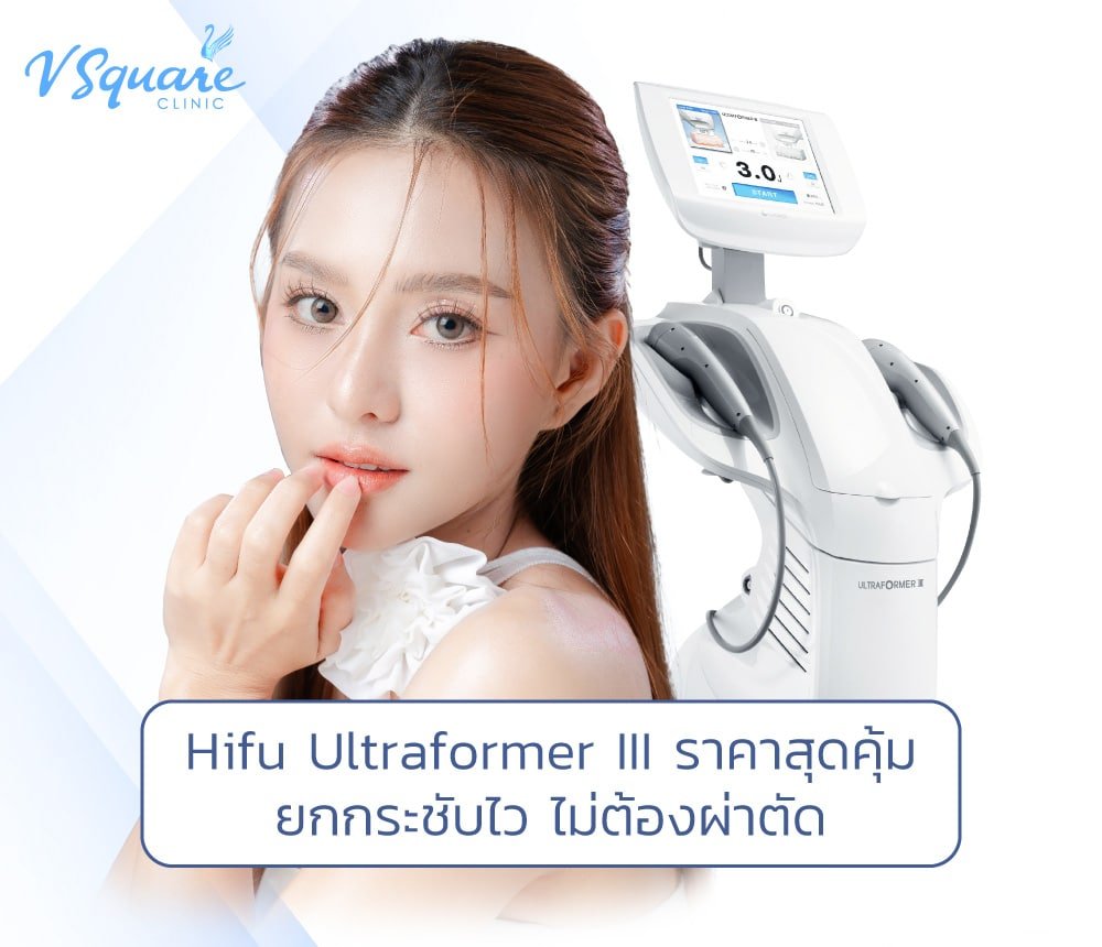 Hifu Ultraformer III โปรโมชั่น 2026 ลดแก้ม ลดเหนียง ราคาประหยัด คุ้มค่า