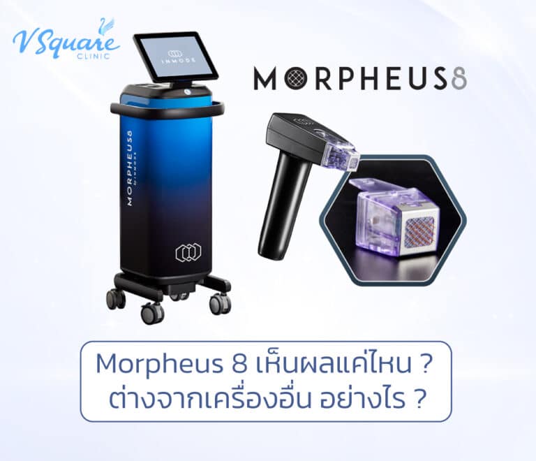 Morpheus 8 ยกกระชับ ใช้เข็ม เจ็บไหม ? ต่างจาก Ulthera อย่างไร