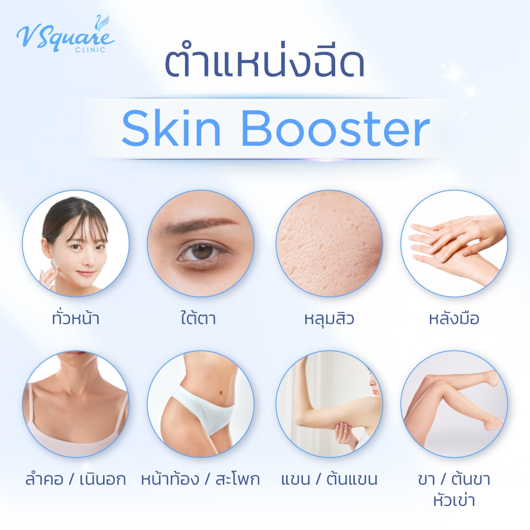 Skin Booster (สกินบูสเตอร์) ยอดนิยมมีอะไรบ้าง ? เลือกฉีดตัวไหนดี