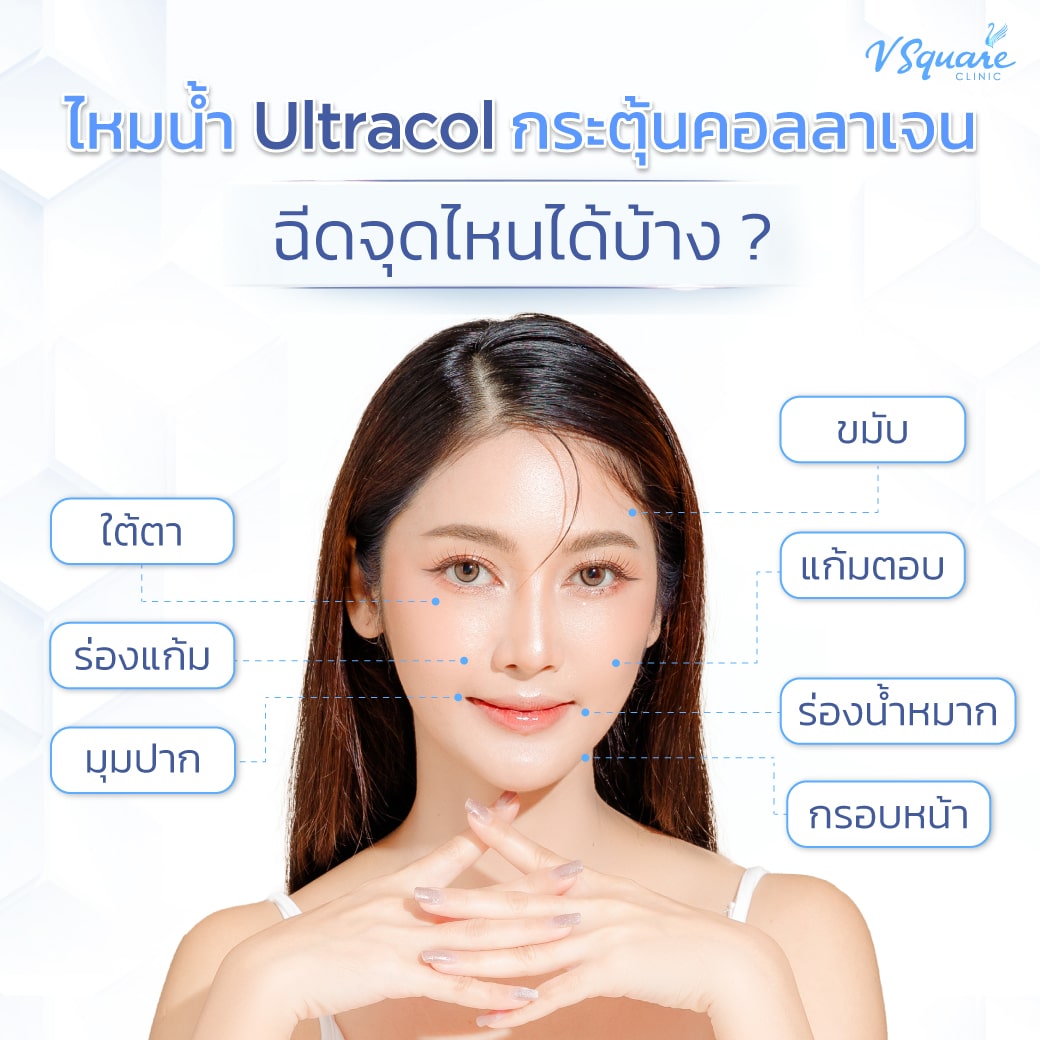 Ultracol ไหมน้ำตัวดัง กระตุ้นคอลลาเจน ที่สาววัย 25+ ต้องรู้ก่อนใคร