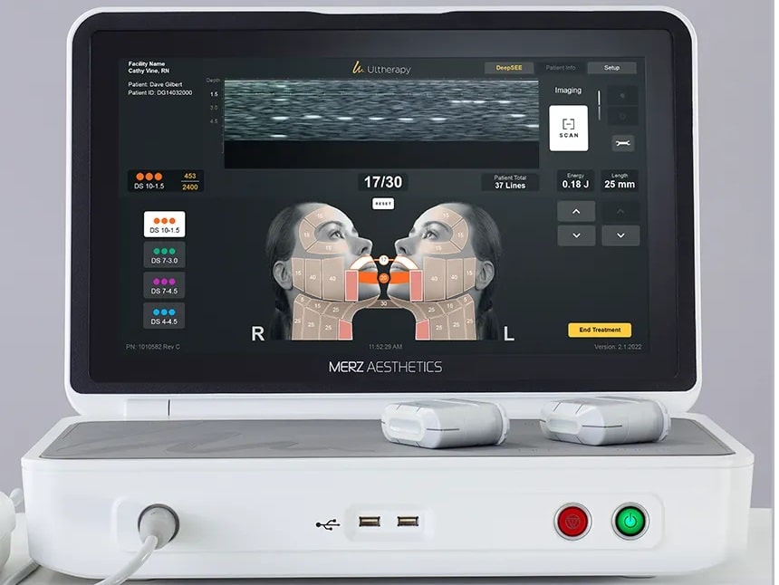 Ulthera Prime นวัตกรรมยกกระชับใหม่ล่าสุด ! เร็วขึ้นกว่าเดิม เจ็บน้อยลง