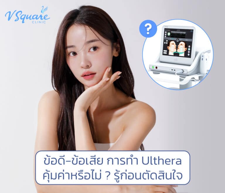 ข้อดี - ข้อเสีย การทำ Ulthera ที่ควรรู้ก่อนตัดสินใจ คุ้มค่าหรือไม่