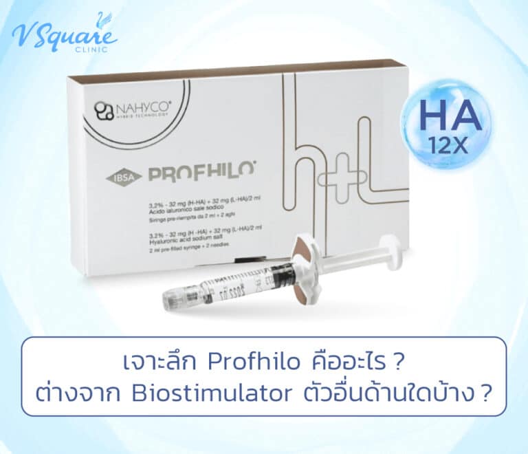 Profhilo ฟื้นฟูผิวให้ดูเด็ก กระตุ้นคอลลาเจน ด้วยนวัตกรรมล่าสุด 2025