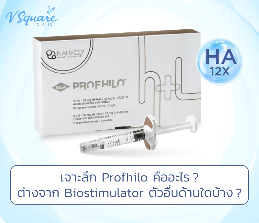 Profhilo ฟื้นฟูผิวให้ดูเด็ก กระตุ้นคอลลาเจน ด้วยนวัตกรรมล่าสุด 2025