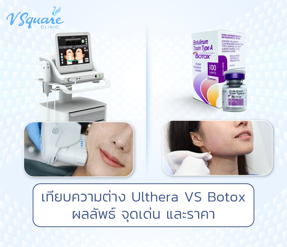 Ulthera กับ Botox ต่างกันยังไง ? เทียบผลลัพธ์ จุดเด่น ราคา