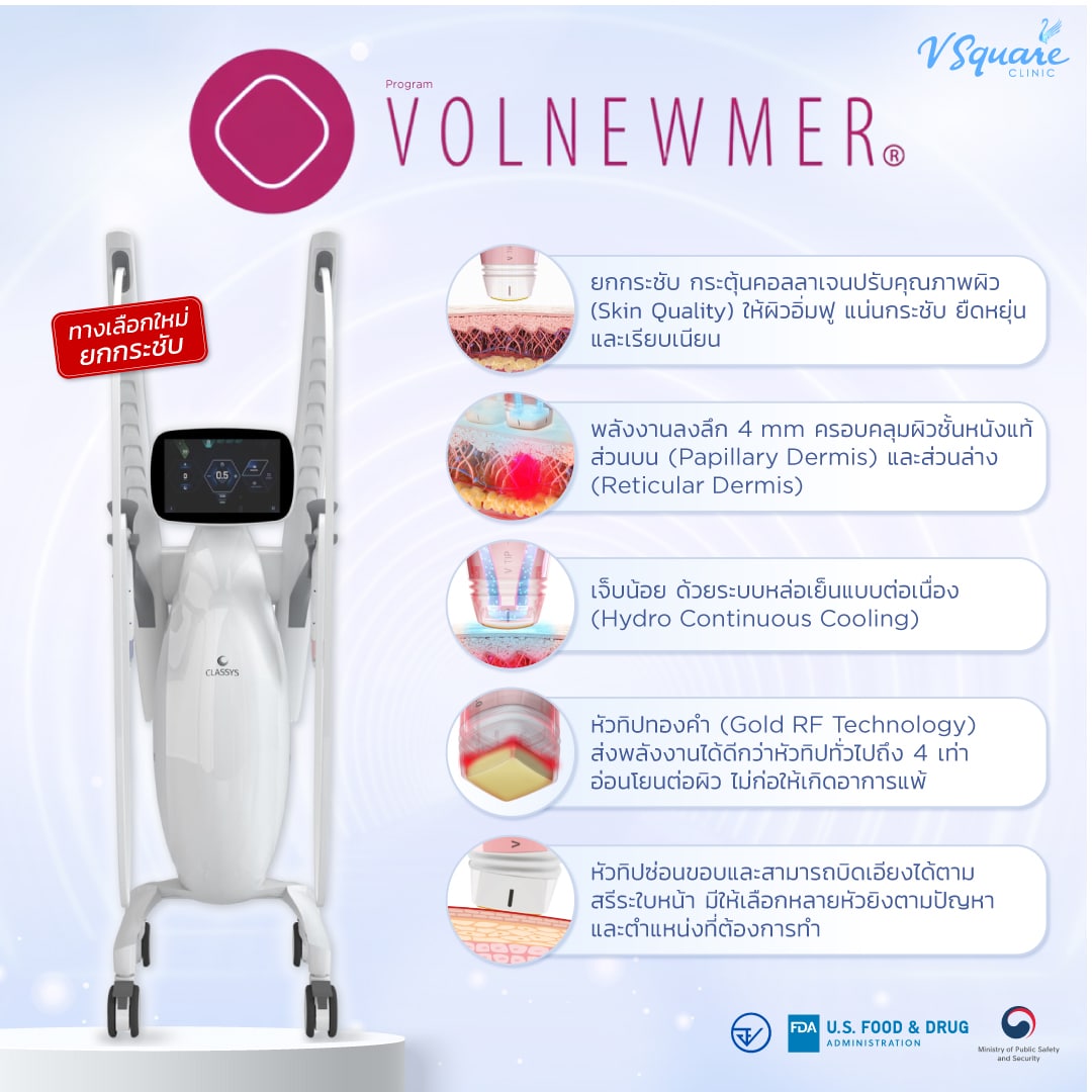 Volnewmer คืออะไร ? เทคโนโลยียกกระชับผิวใหม่ล่าสุด 2025