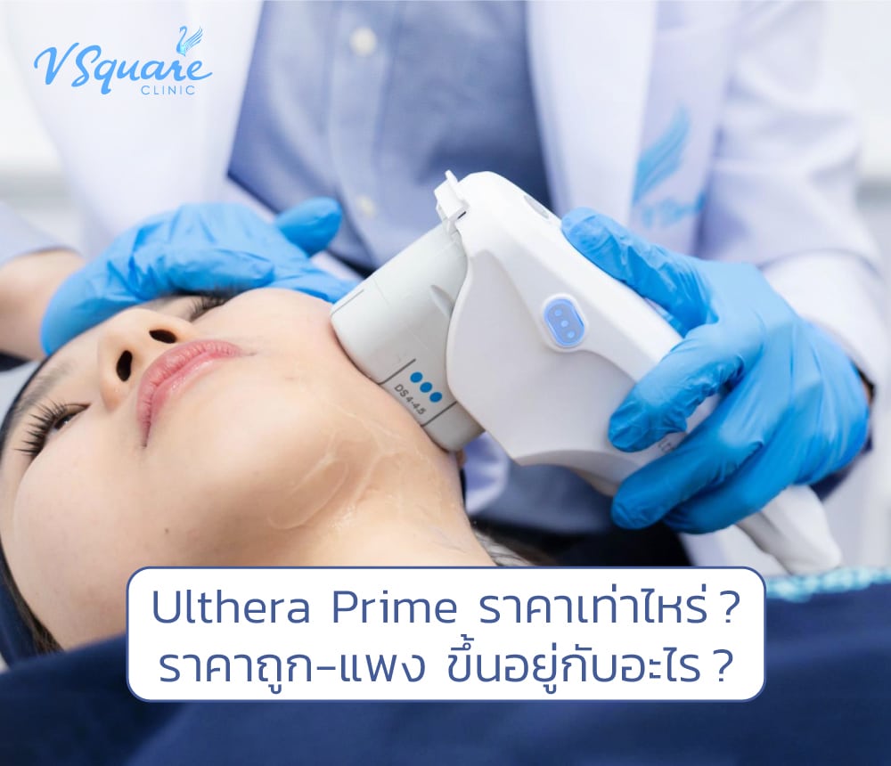 Ulthera Prime ราคาเท่าไหร่ ส่องโปรโมชัน 2026 เทียบราคาก่อนทำ