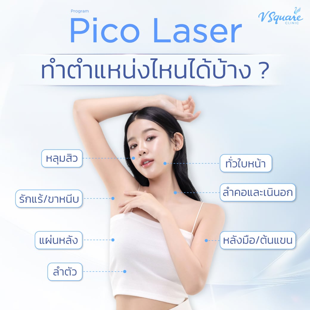 Pico Laser คืออะไร ? เทียบรุ่น ผลลัพธ์ ราคา ครบในที่เดียว