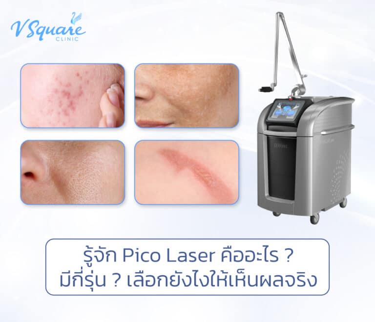 Pico Laser คืออะไร ? เทียบรุ่น ผลลัพธ์ ราคา ครบในที่เดียว