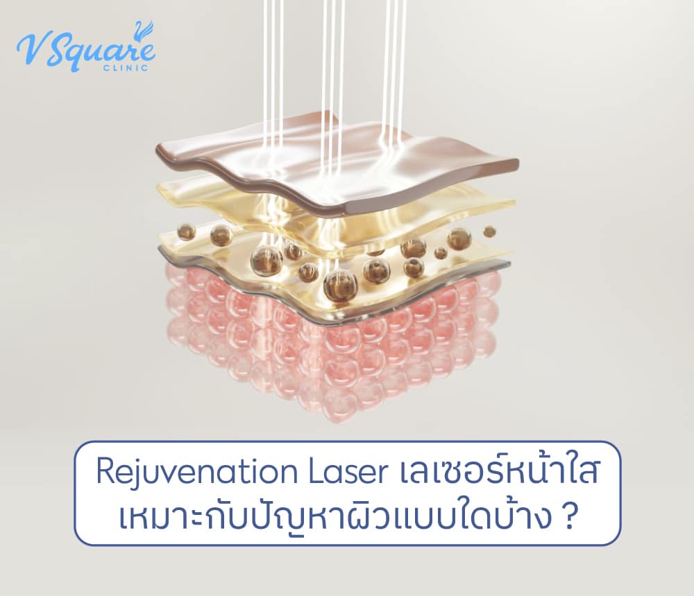 รู้จัก Rejuvenation Laser ตัวช่วยฟื้นฟูผิวใส เรียบเนียน